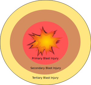 Know how deadly ‘Blast over Pressure’ is?