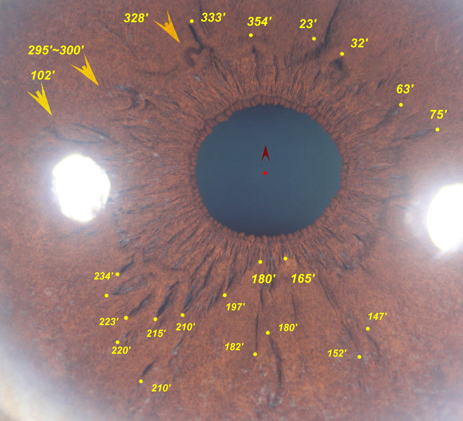 Modern & Multidimensional Iridology: Multidimensional Iridology ...