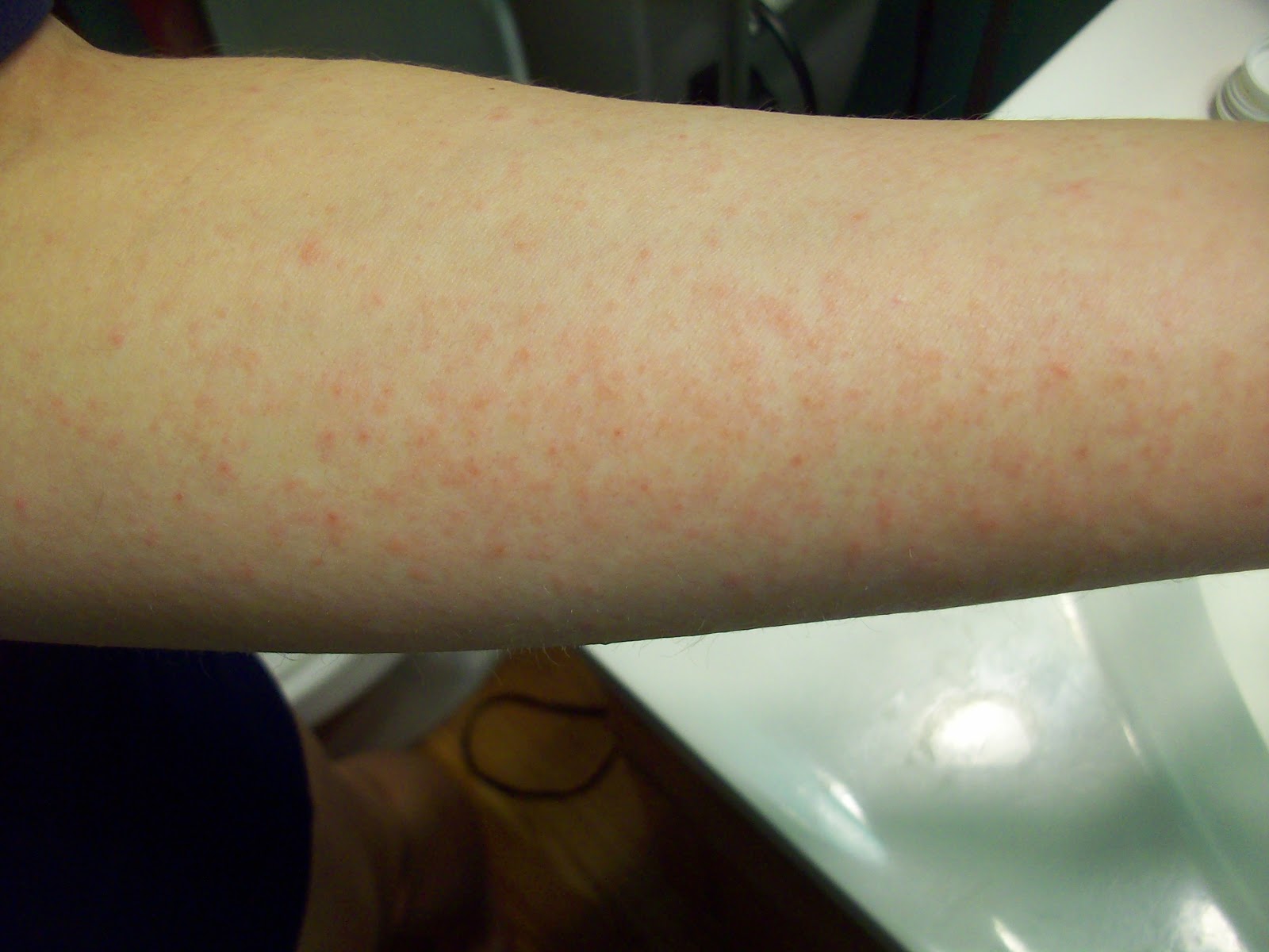 A Walk in the Parks with 65 Roses: I have pupps...