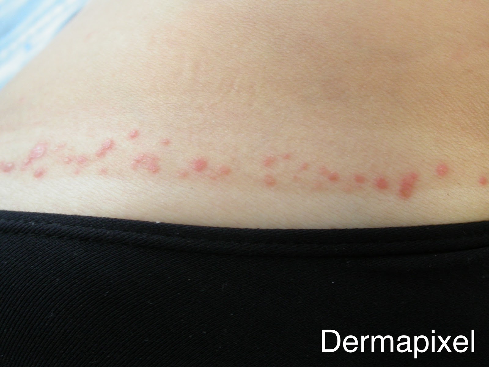 Dermapixel: junio 2018