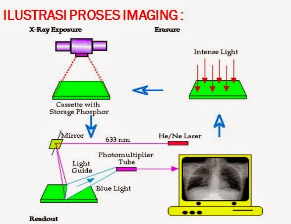catatan radiografer: Computed Radiography