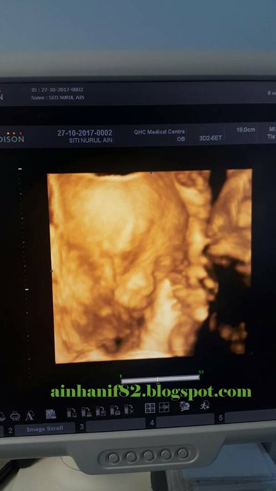 Kedai Vitamin Online Mommy Ain: My Twin Pregnancy Story Part 4 ~ Gambar ...