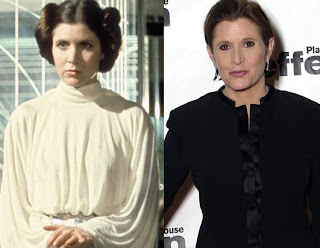 Carrie Fisher Plastic Surgery