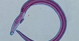 INFECTIOUS DISEASE: Schistosomiasis or snail fever