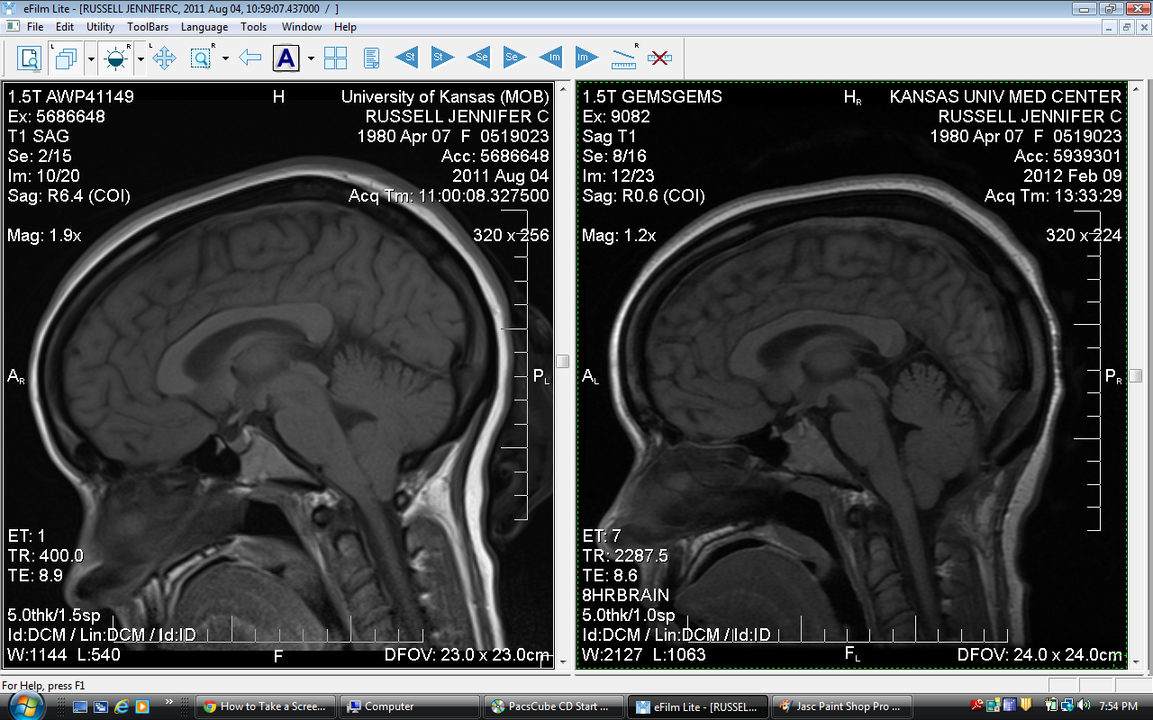 Life Without A Dress Rehearsal