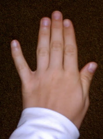 make a run for it: The Pinky Problem