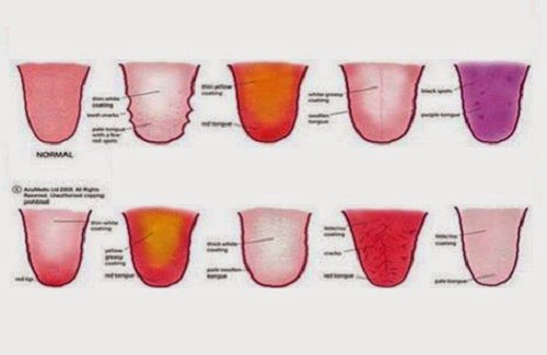 TU COLOR DE LENGUA PUEDE REVELAR TU ESTADO DE SALUD ~ Sana Tu Vida