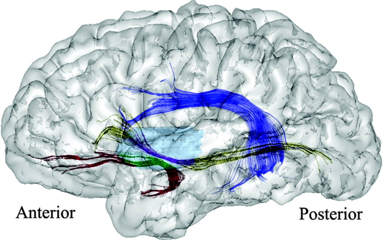 The Arcuate Fasciculus