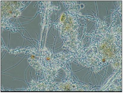 Microbiologie des boues activées | Traitement Des Eaux Usées