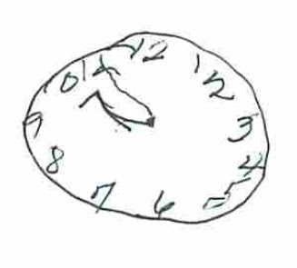 Sleep and Neurology: Dementia Clocks