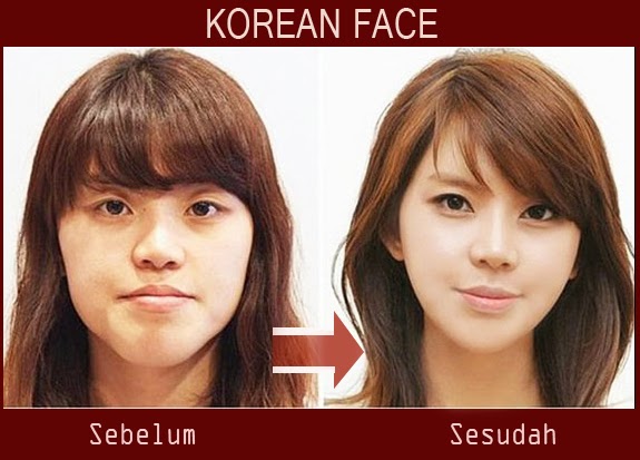 IDEKU - PENGALAMANKU DALAM SEBUAH TULISAN: OPERASI PLASTIK WAJAH ORANG ...