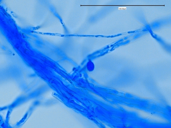 Fun With Microbiology (What's Buggin' You?): Sepedonium species