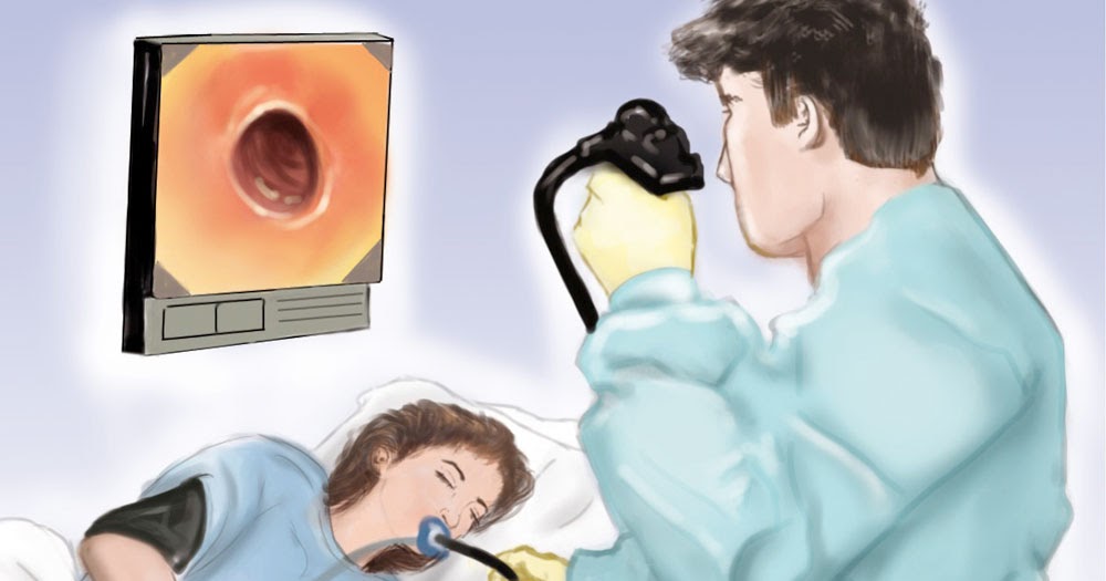 Endoscopy Over The Years From The Unpleasant End Of The Tube