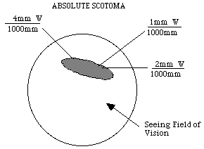 My OpToMeTRy JouRNey: ULanGKaji OpToMetRi : UjiaN MeDaN PenGLiHataN ...