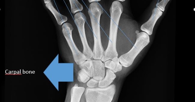 Anatomy-Logia: El Anatomisi