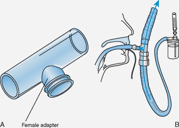 PROCEDIMIENTOS DE ENFERMERÍA: OXIGENOTERAPIA