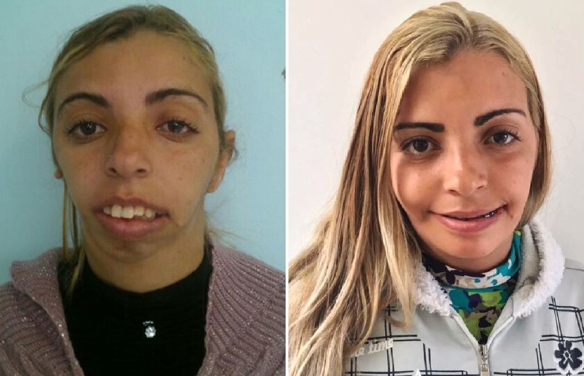 Social Trends : rosto-deformado-de-belga-apos-bolada-vira-grafite ...