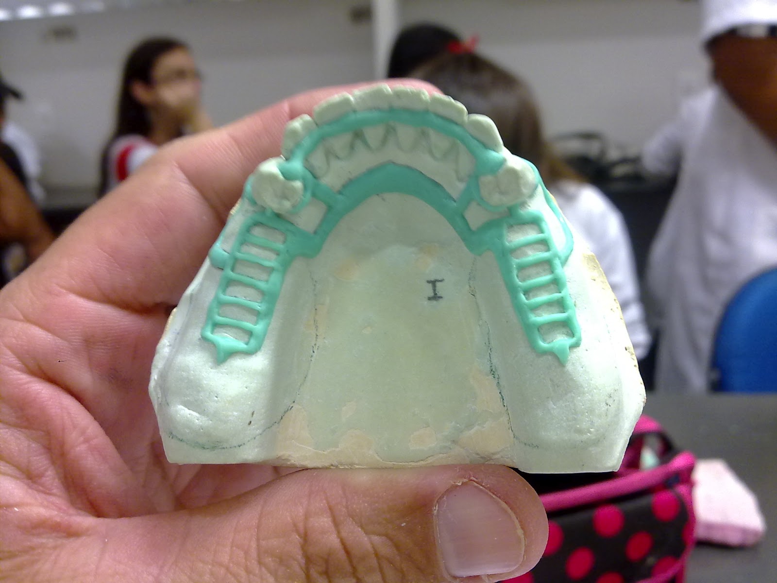 Protese Dentária: PPR - Algumas dicas para Avaliação Final - Profº ...