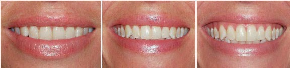 Omni Dental Group: Smile (Lip) Line