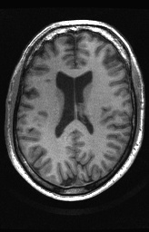 Imaging and Preprocessing Tips and Tricks: Aligning to a Standardized ...