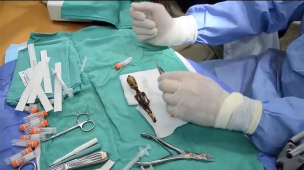 Ecotur esoterico: El forense vasco Francisco Etxeberria dictaminó en ...