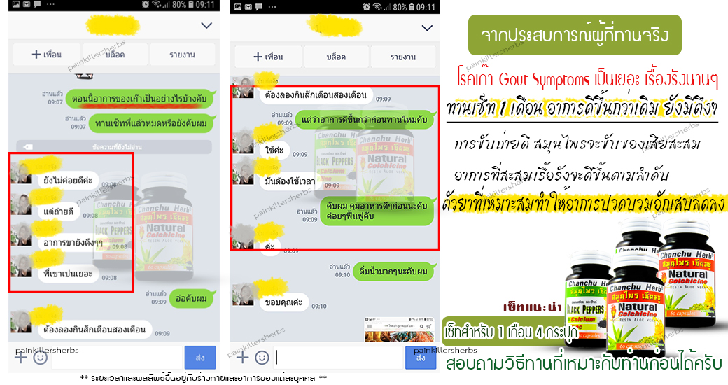 โรคเก๊าท์ Gout Symptom