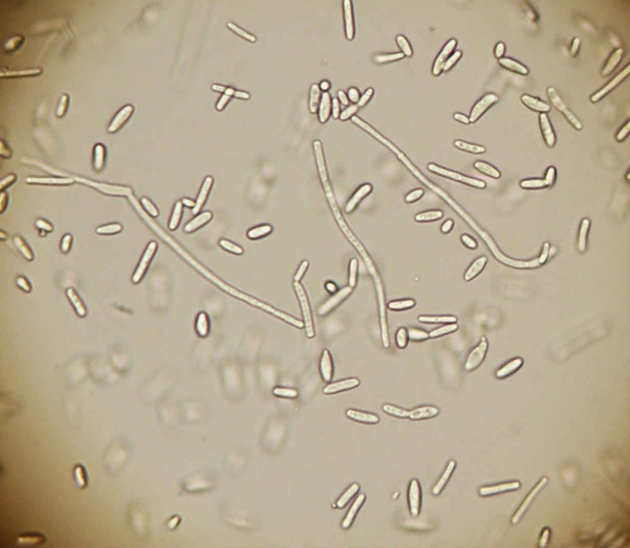 ATLAS MICOLOGIA: MAGNUSIOMYCES CAPITATUS
