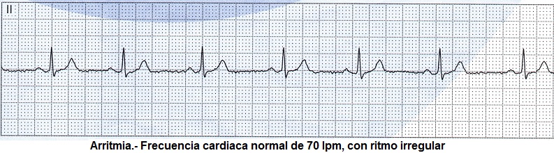 CLASES DE MEDICINA: ELECTROCARDIOGRAFIA II