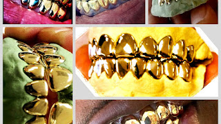 Permanent White Gold Teeth Prices - Gold Choices