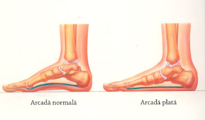 IKineto - Porția ta zilnică de sănătate