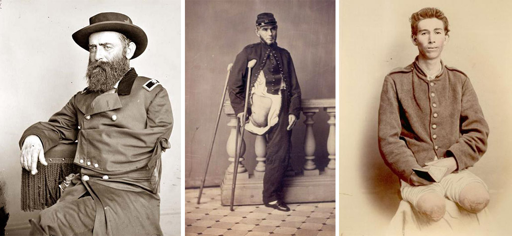 Redwood's Medical Edge: The Civil War and Prosthetic Limbs: 1/2