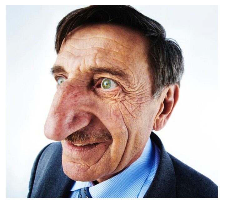 Check out viral photos of the man with the longest nose in the world ...