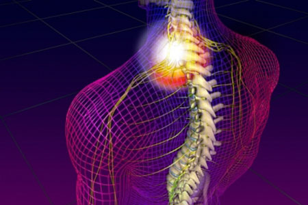 DISKUS HERNIJA: Simptomi