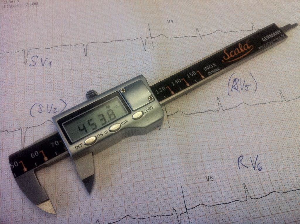Cardiologist saves tons of time with this new automatic ECG Ruler