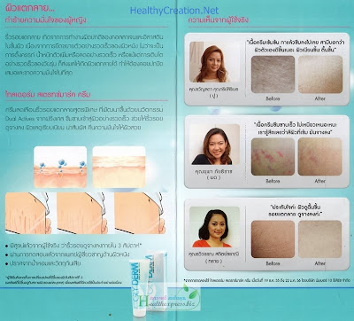 Mom'sHug LIFESTYLE ღ: GLY DERM- THE SPECIALIST FOR STRETCH MARK