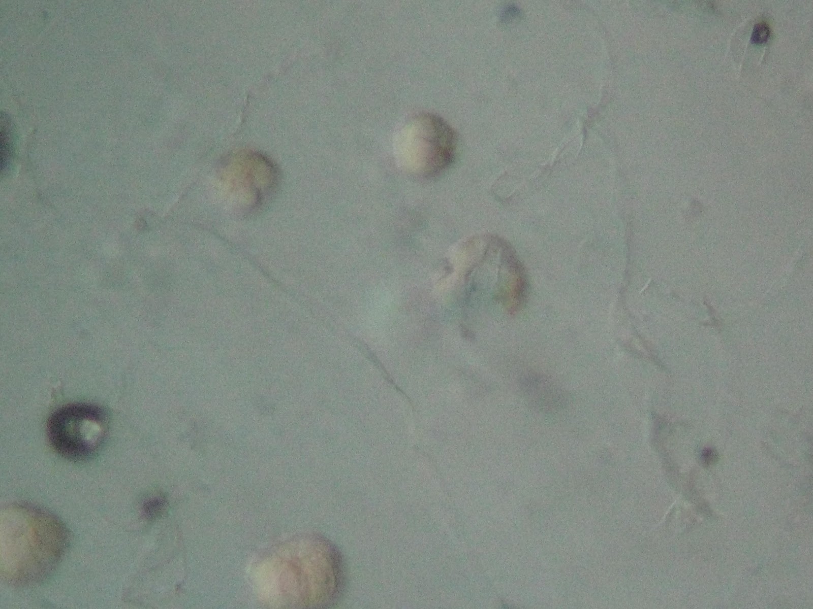 Agro Scientist: Fitopatologia Agricola: FOtos de Oidiums y Carbones
