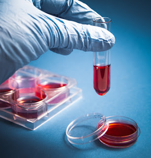 Soy Criminalista : HEMATOLOGIA FORENSE