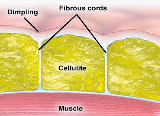 Libre De Celulitis: Ejercicios Para La Celulitis: El Método SYMULAST