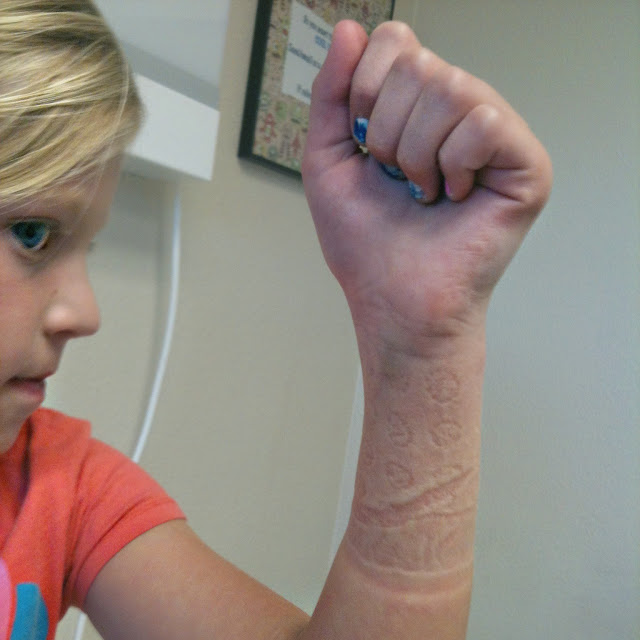 The Merrill Six: Piper is finally free from the stinky cast!