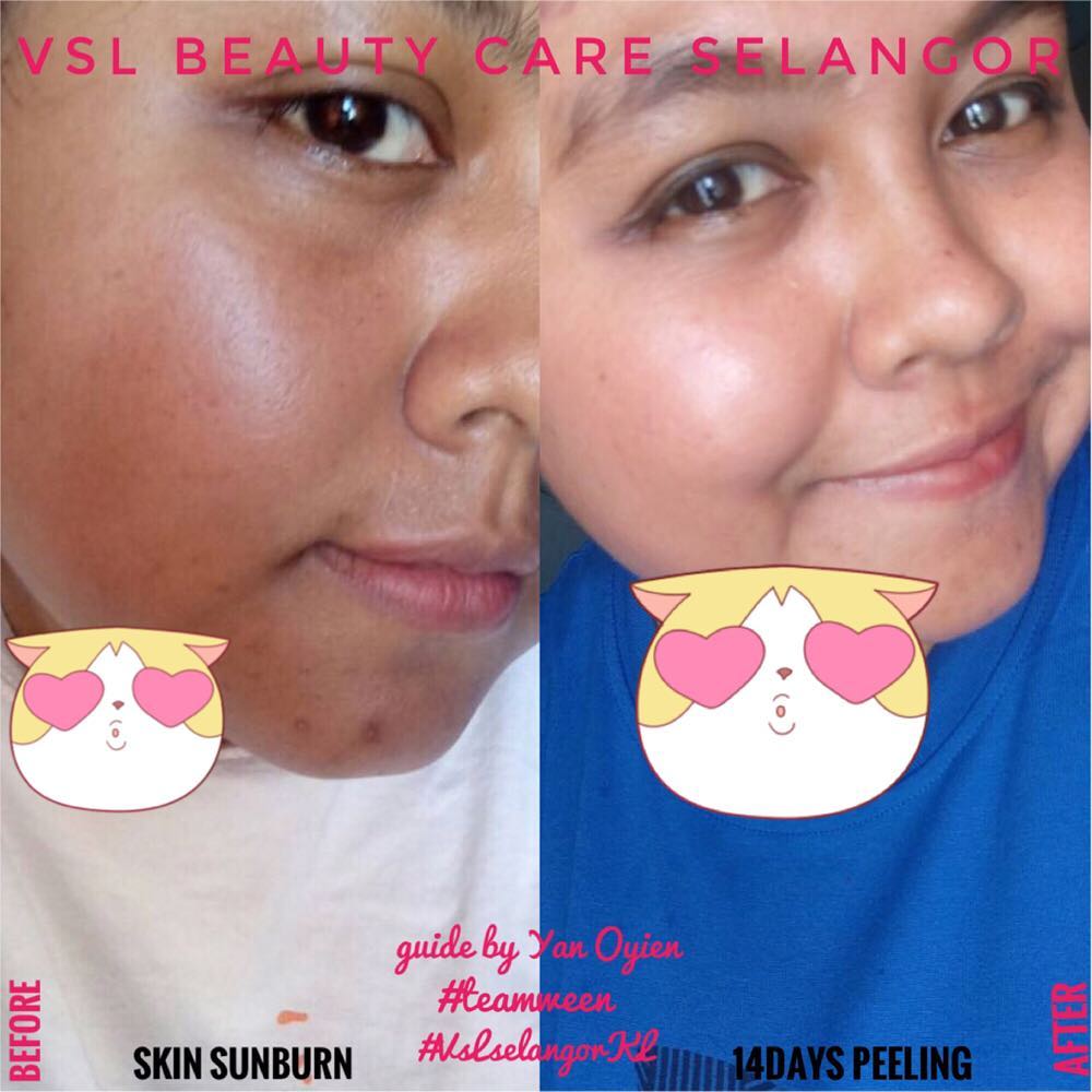 PRODUK PEMUTIH DAN PENGELUPASAN VSL BEAUTY CARE: July 2018