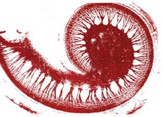 Understanding Williams Syndrome: Ears