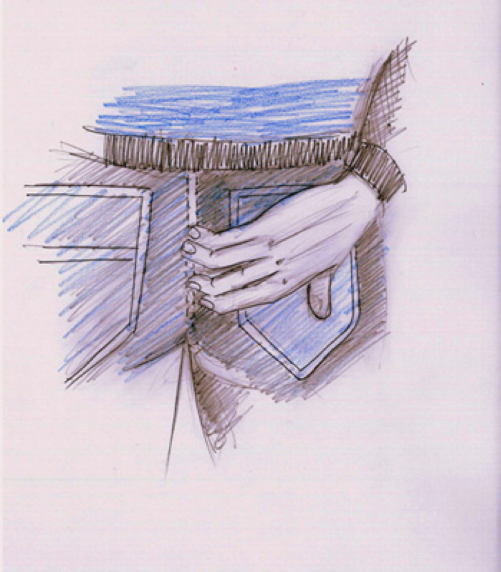 WeCare: Itchy Anus (Pruritus Ani) and Chinese Medicine (Western Medical ...