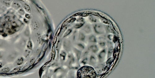 Sofat Infertility & Women Care Centre India: What is the Laser assisted ...