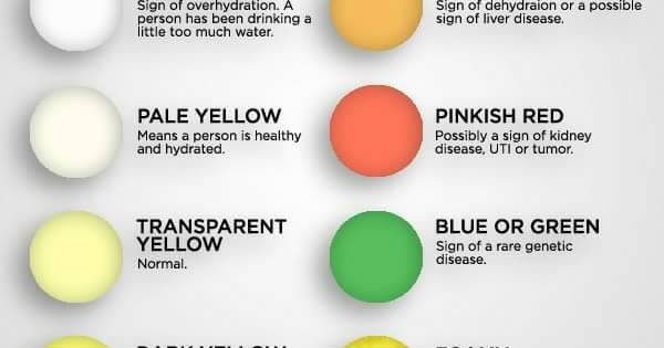 What The Colour Of Your Urine Says About Your Health - loadedwise