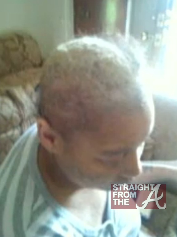 10 People with Unbelievable Medical Conditions | M bizarre