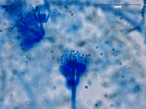 Fun With Microbiology (What's Buggin' You?): Penicillium species