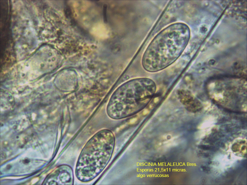 Mintegui - Argazkiak: Discina