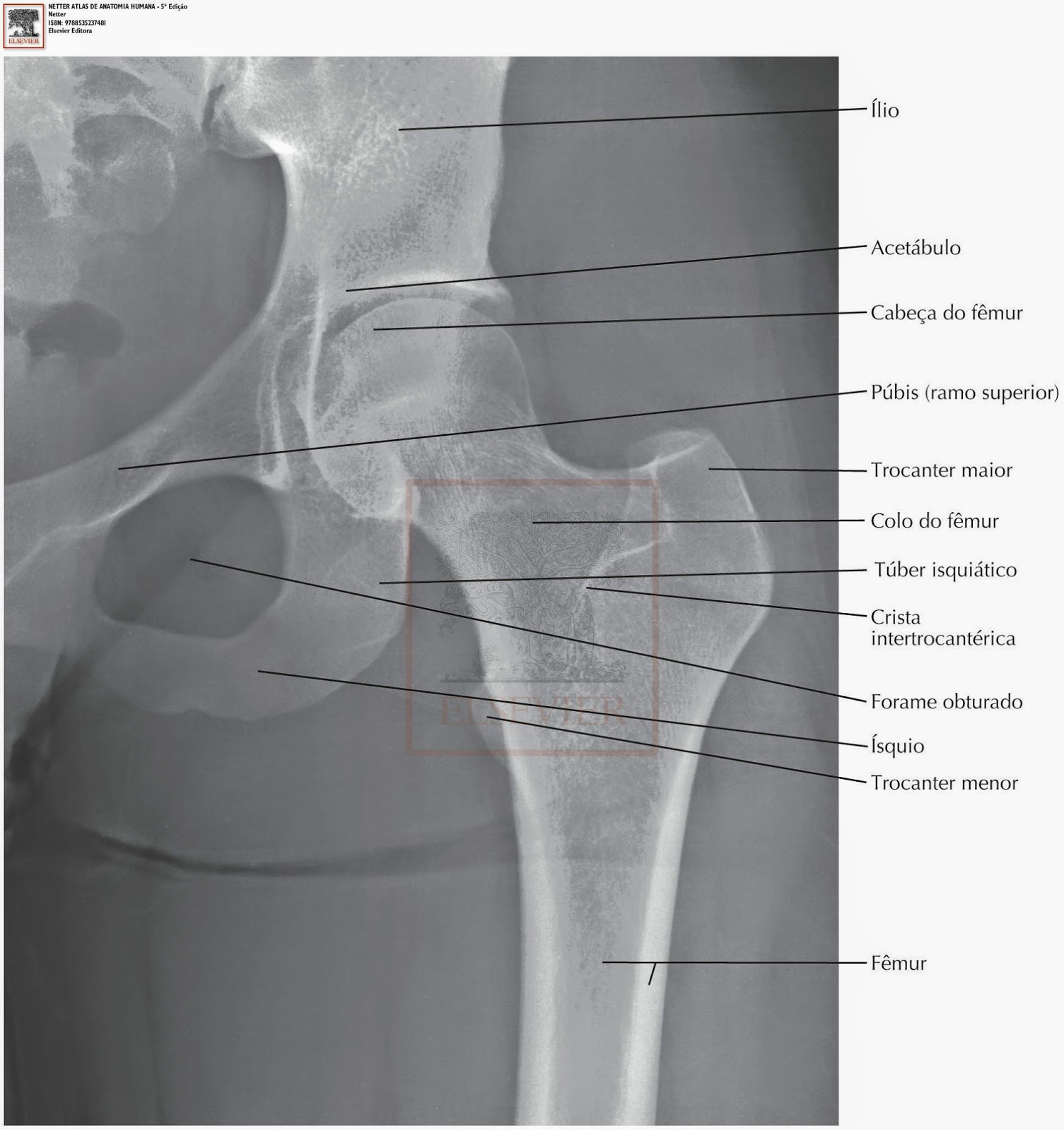 Osso Do Quadril Sem Rotulo