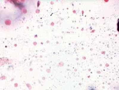 [Microbiology] Atlas of Fecal Analysis | Free Medical Atlas