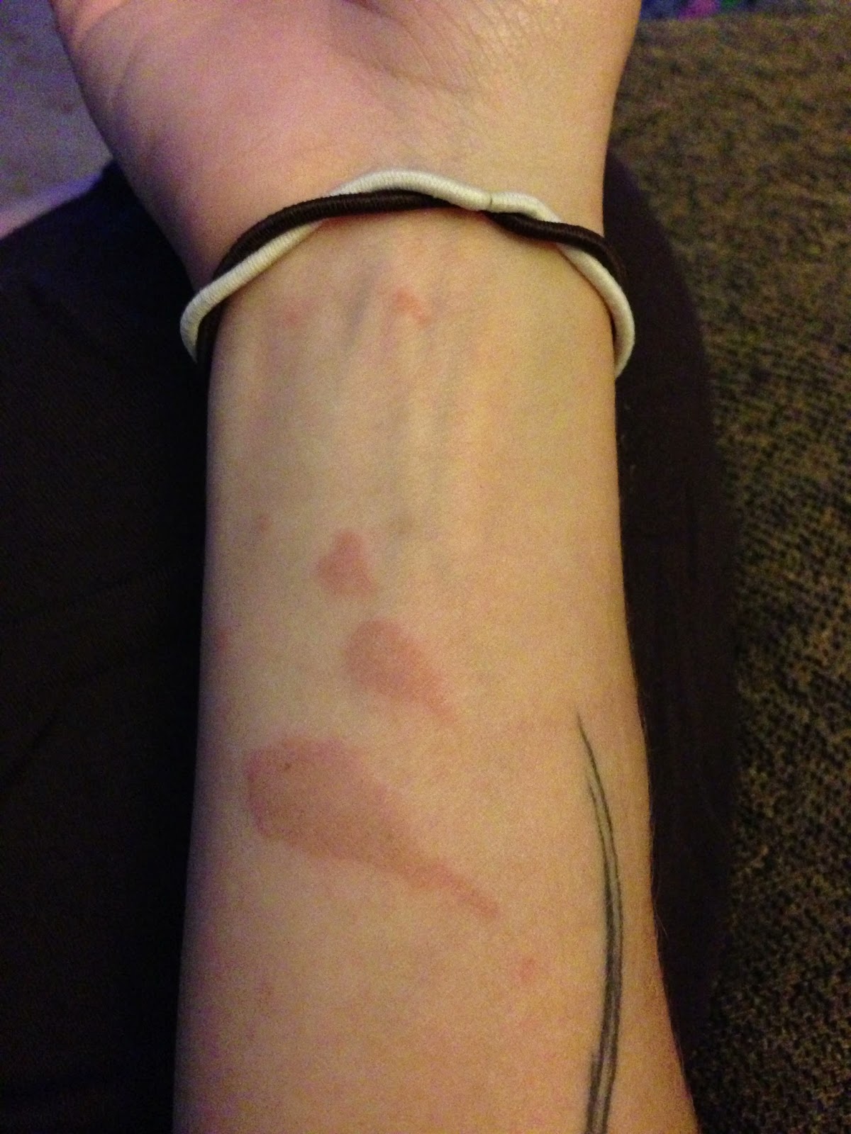 A New Day: natural home remedies for minor burns {aka I fought the ...